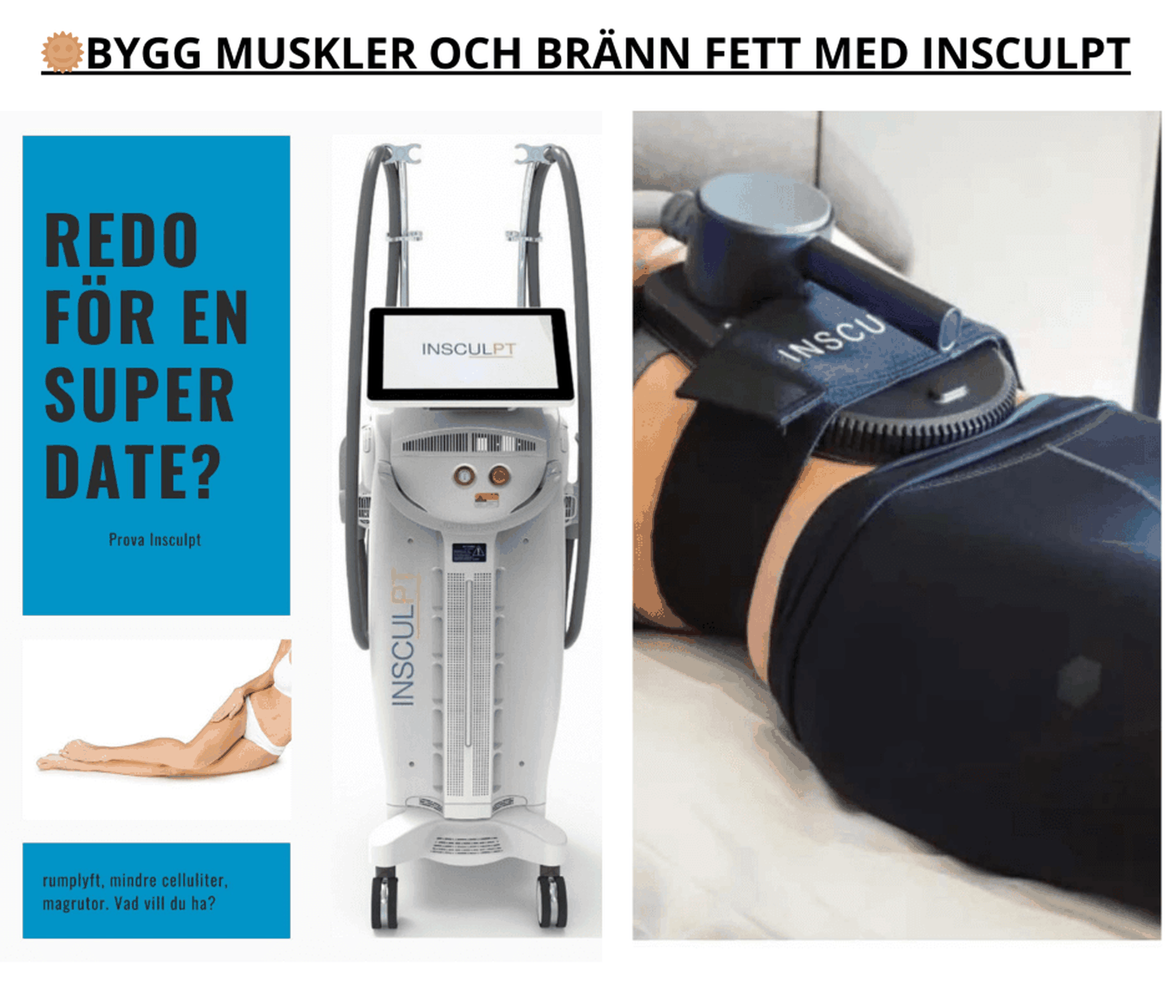 Insculp – MIPT